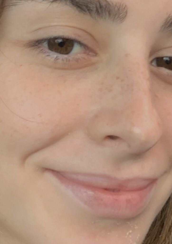 Vitacid Plus Resenha: Antes e Depois e Benefícios – Protocolo da Pele